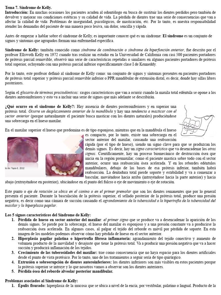Tema 7. Síndrome de Kelly | PDF | Hueso