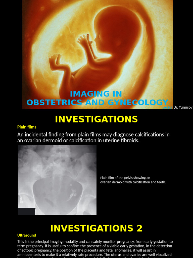 Imaging Techniques in Obstetrics & Gynecology | PDF | Ovarian Cancer ...