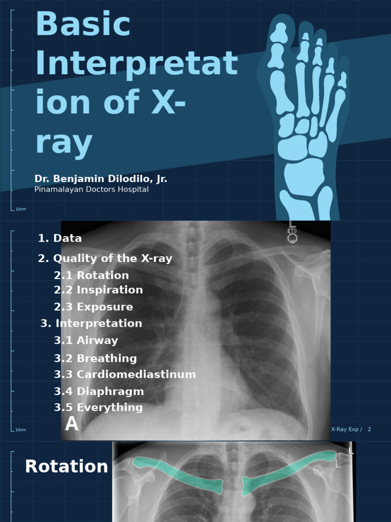 Basic Interpretation of X-Ray | PDF