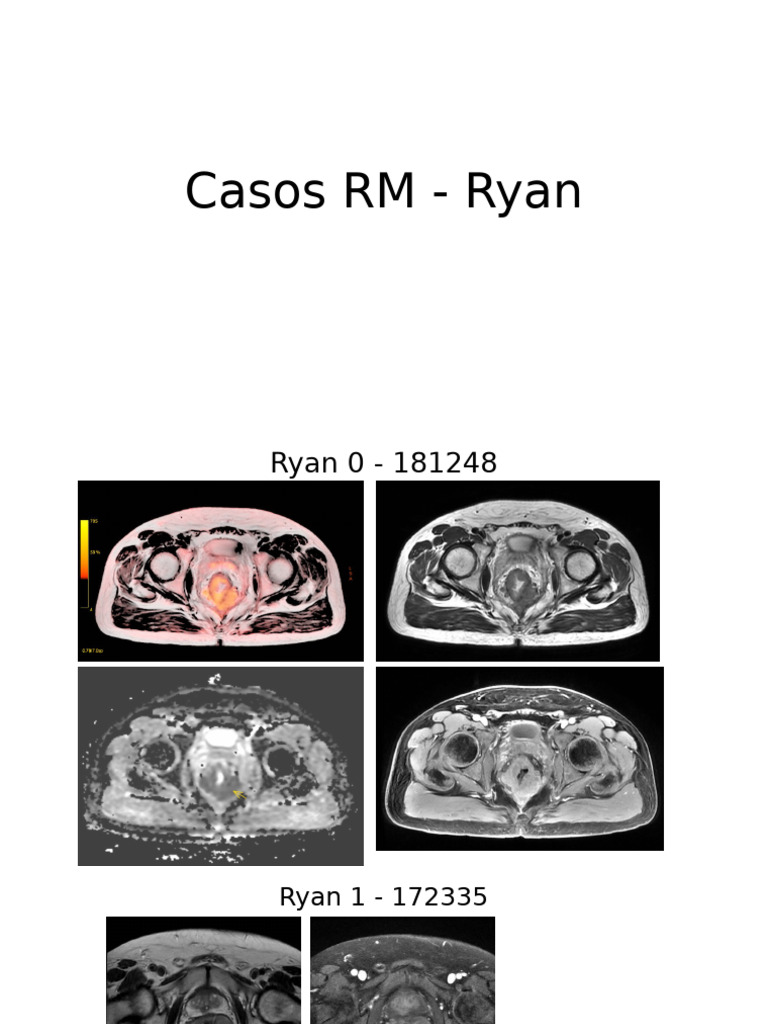 Casos RM - Ryan | PDF