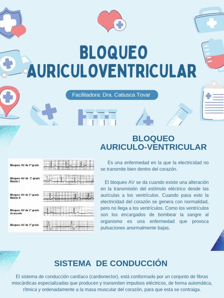 Bloqueo AV - 20240924 - 090017 - 0000 | PDF | Electrocardiografia | Corazón