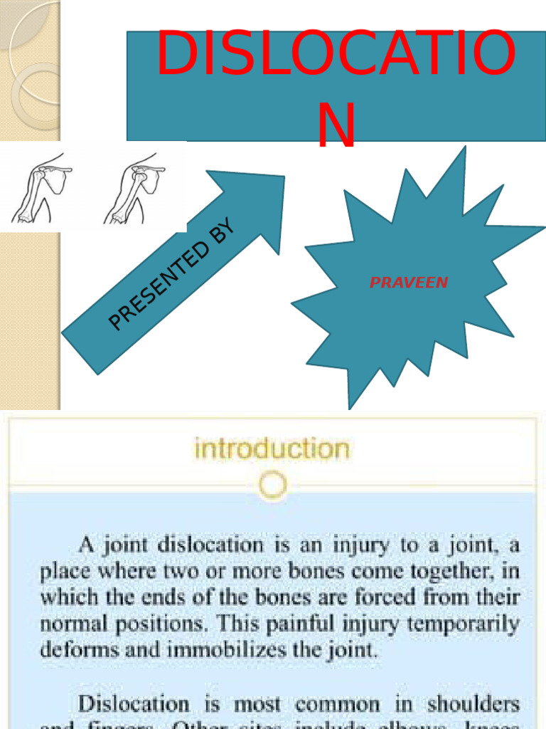 Dislocation | PDF