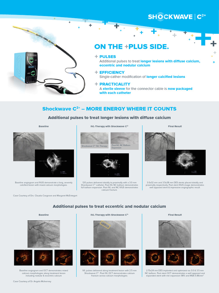 Shockwave C2 Tech Sheet | PDF | Coronary Circulation | Coronary Artery ...