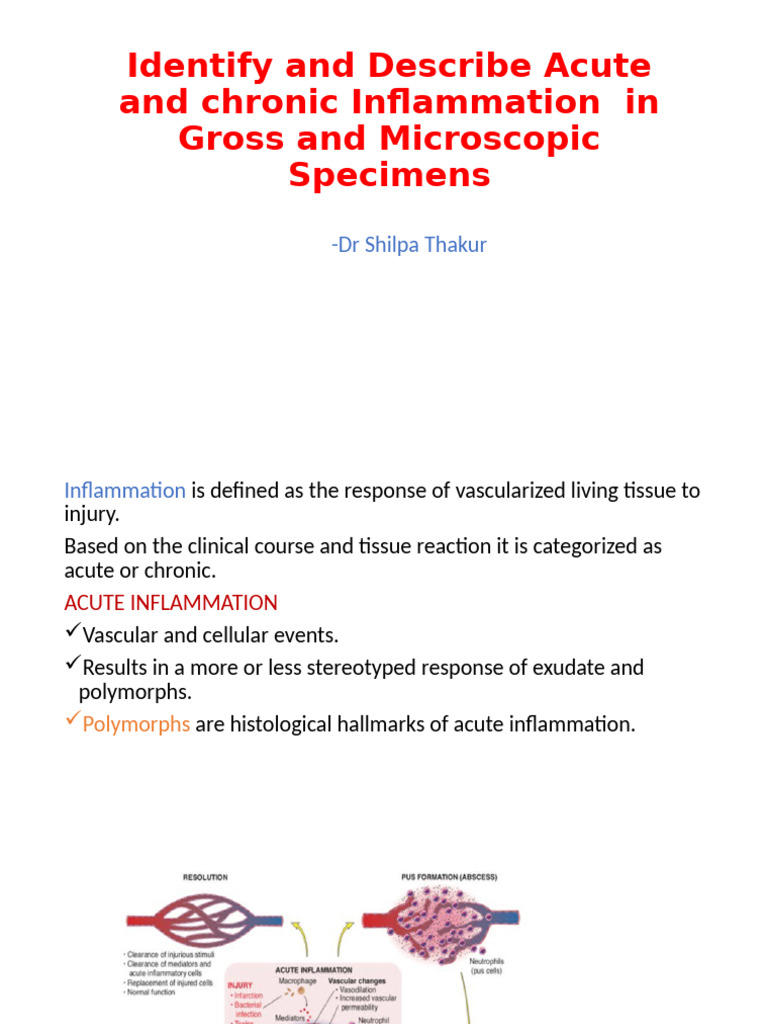 Inflammation: Acute vs Chronic Analysis | PDF | Inflammation | Medical ...