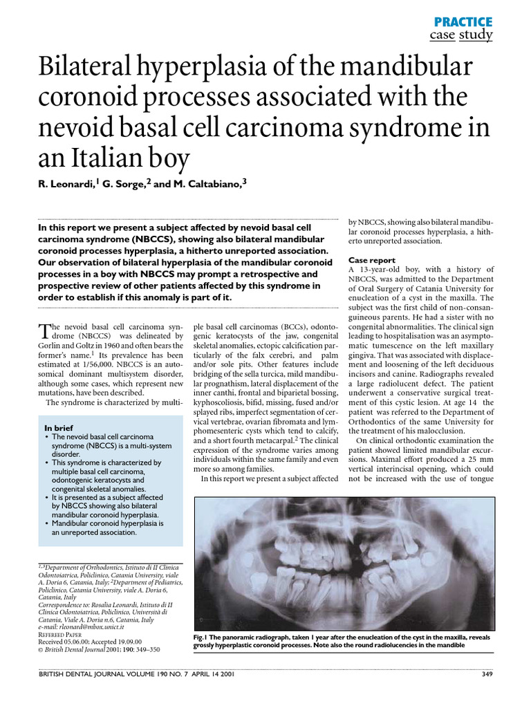 2001 - Bilateral Hyperplasia of The Mandibular Coronoid Processes ...