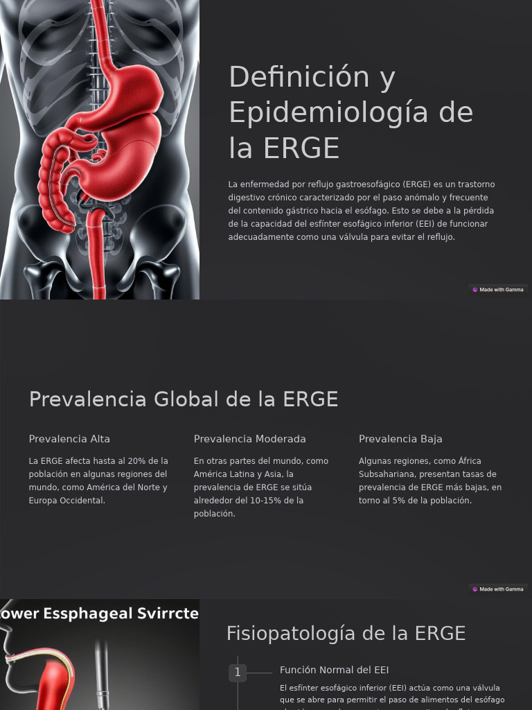Definicion y Epidemiologia de La ERGE | PDF | La enfermedad por reflujo gastroesofágico ...