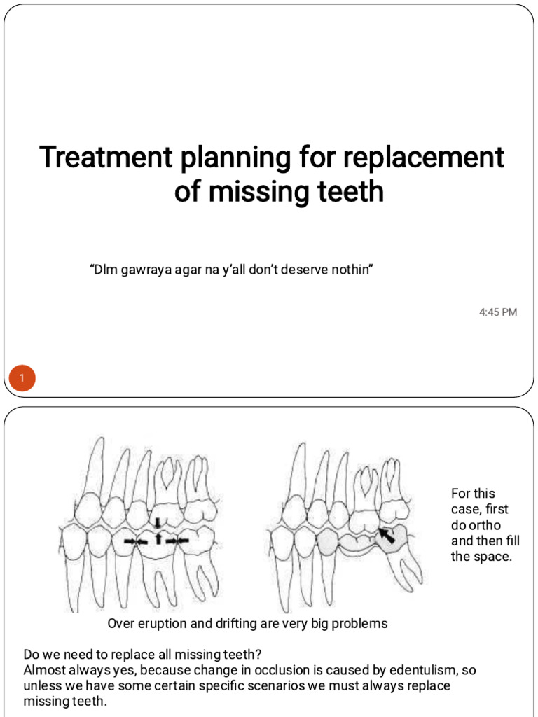 Treatment Planning (STUDENTS NOTES) | PDF | Dental Implant | Dentures