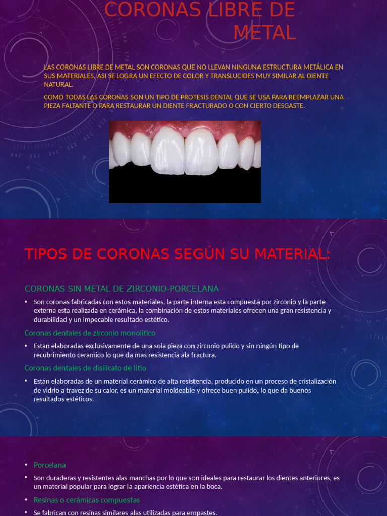 Ventajas y Tipos de Coronas Sin Metal | PDF