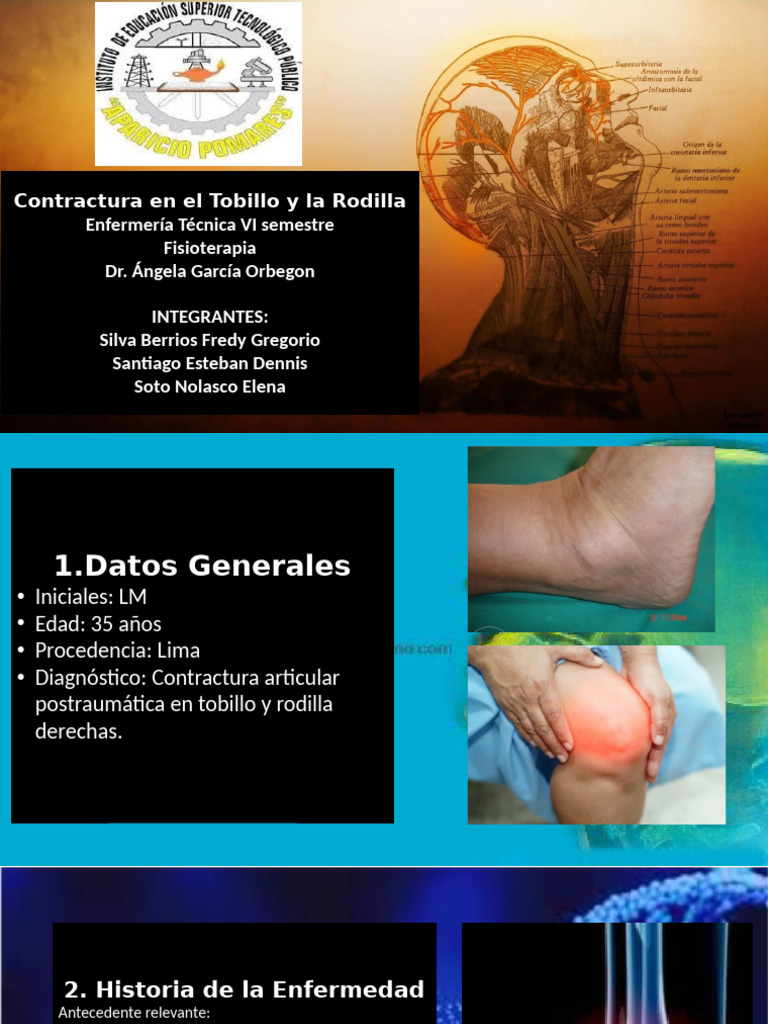 PPT CONFRACTURA DE TIBIA Y RODILLA | PDF