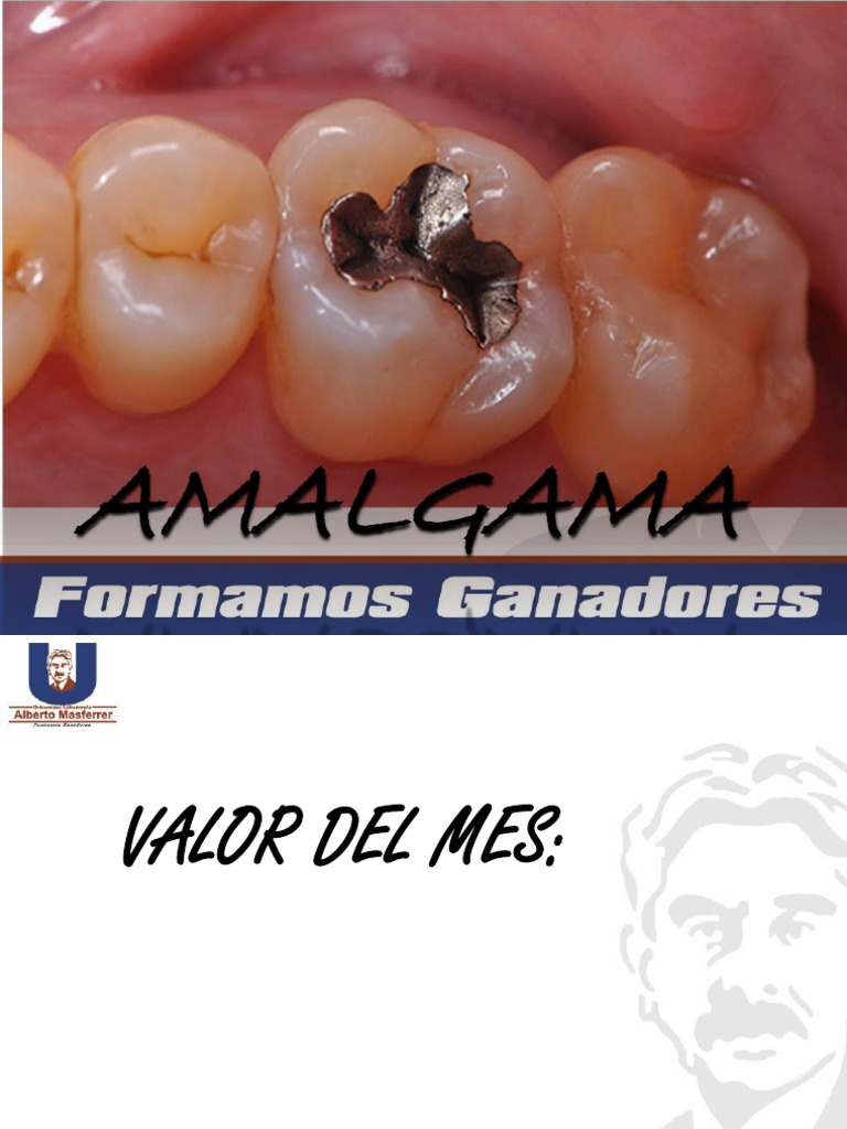 Amalgama Dental: Composición y Manipulación | PDF | Cobre | Mercurio ...