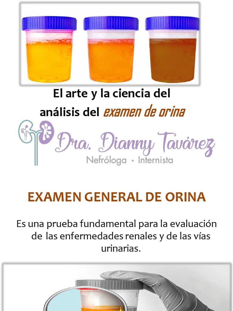 Análisis del Examen de Orina: Guía Completa | PDF | Especialidades ...