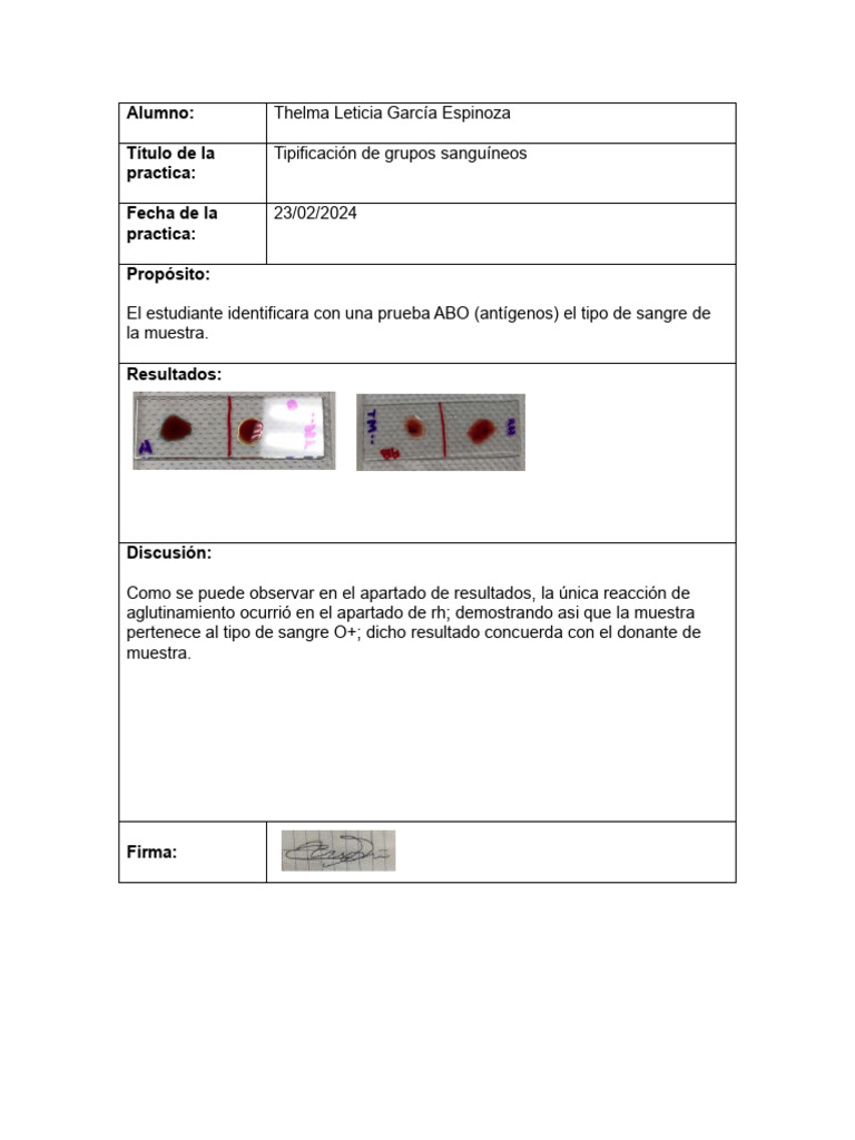 Tipificacion de Grupos Sanguineos - Practica | PDF