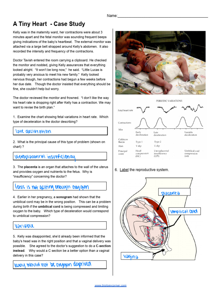 Fetal Heart Issues: A Case Study | PDF | Heart | Ventricle (Heart)