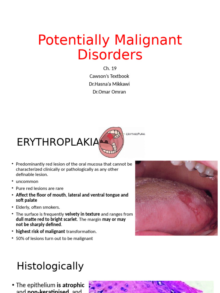 Oral Potentially Malignant Disorders | PDF | Medical Specialties ...