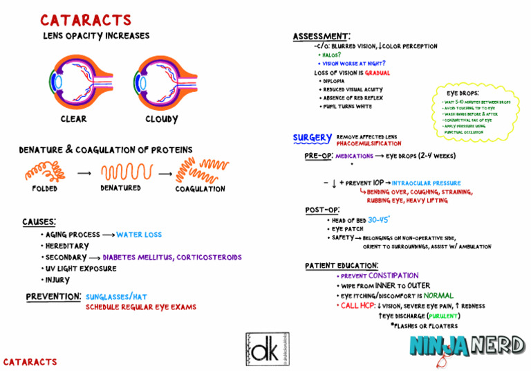 Nursing Pathology 004 Cataracts NCLEX Illustrations Handout | PDF