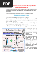 Índices Sokolow y Lewis en EKG | PDF
