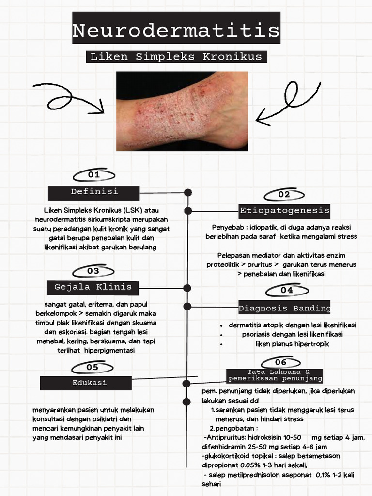 Neurodermatitis | PDF