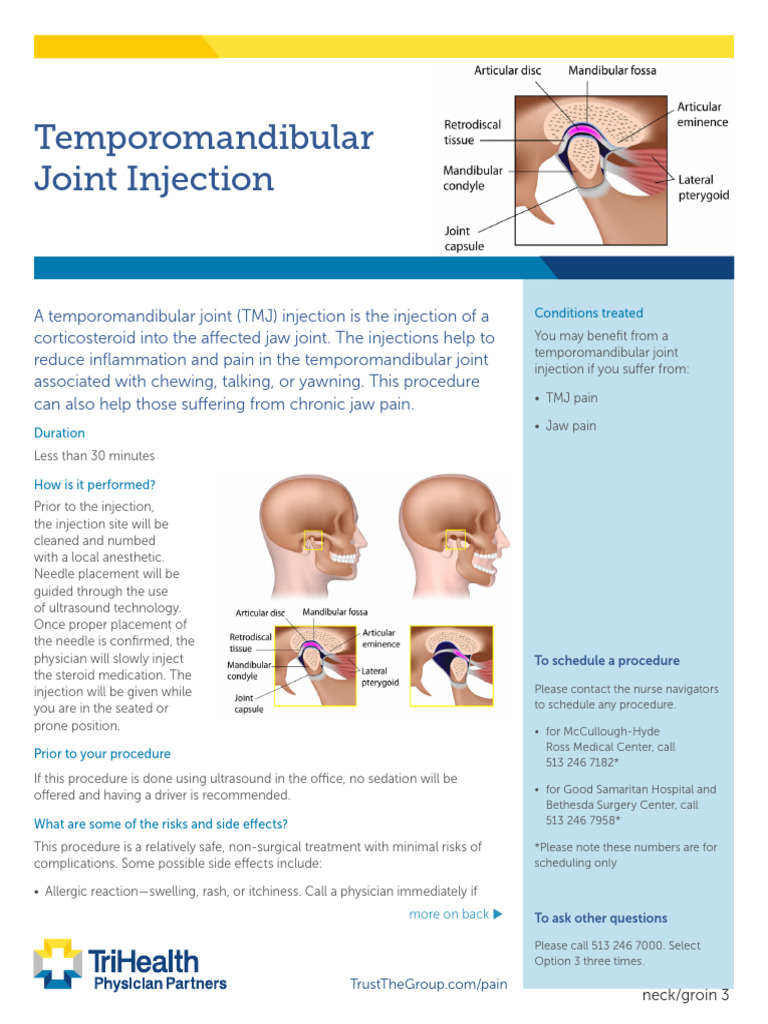 Temporomandibular Joint Injection | PDF | Injection (Medicine) | Pain