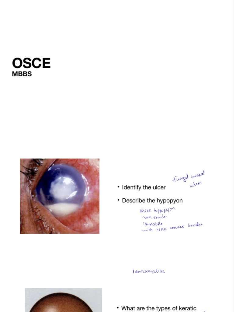 OSCE (1) | PDF | Senses | Clinical Medicine