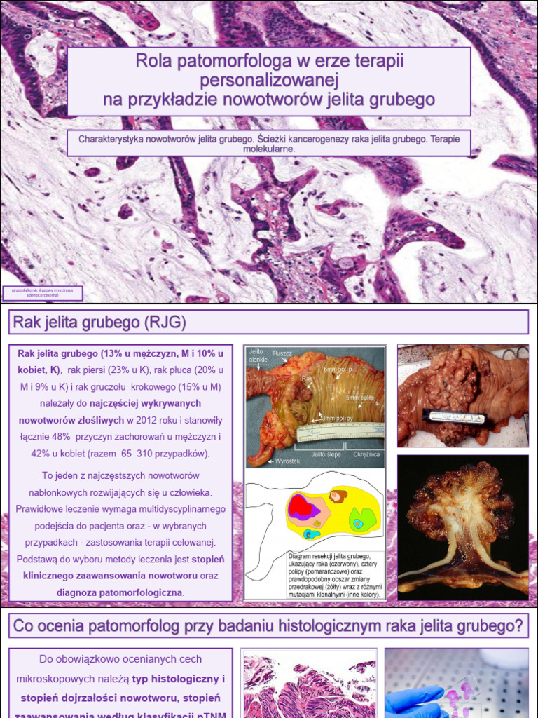 Rola Patomorfologa W Erze Terapii Personalizowanej. Rak Jelita Grubego. | PDF