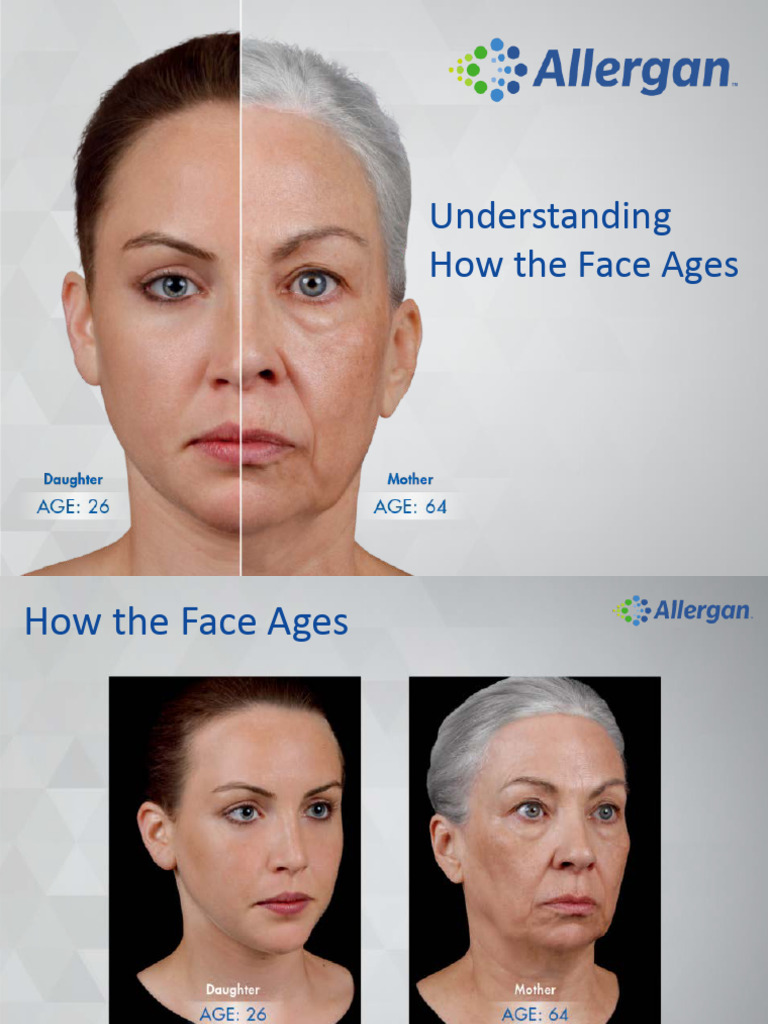 Allergan - Mudanças Na Face - Facial Aging | PDF | Face | Wrinkle