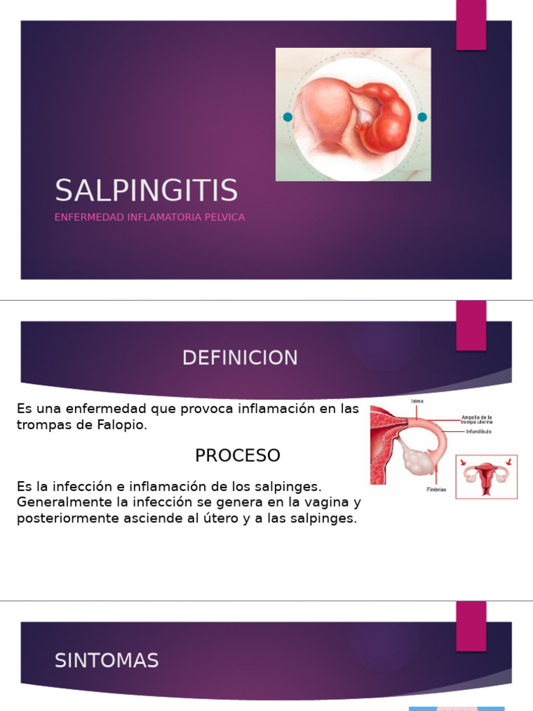 Salpingitis: Definición y Tratamiento | PDF | Enfermedades y trastornos ...