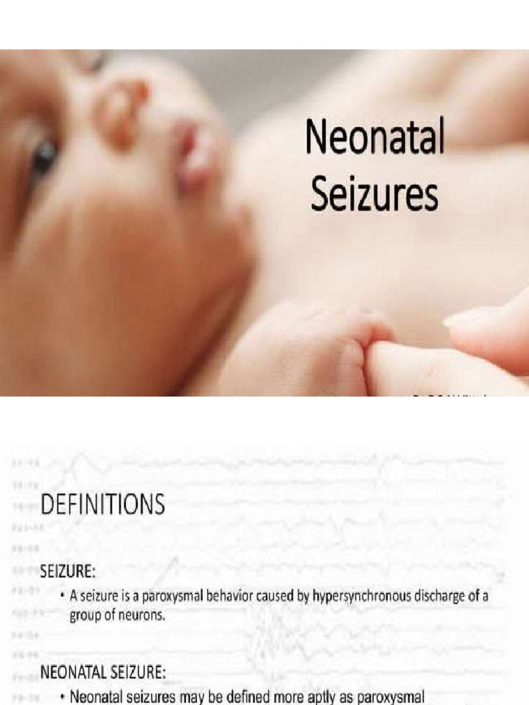 Neonatal Seizures | PDF