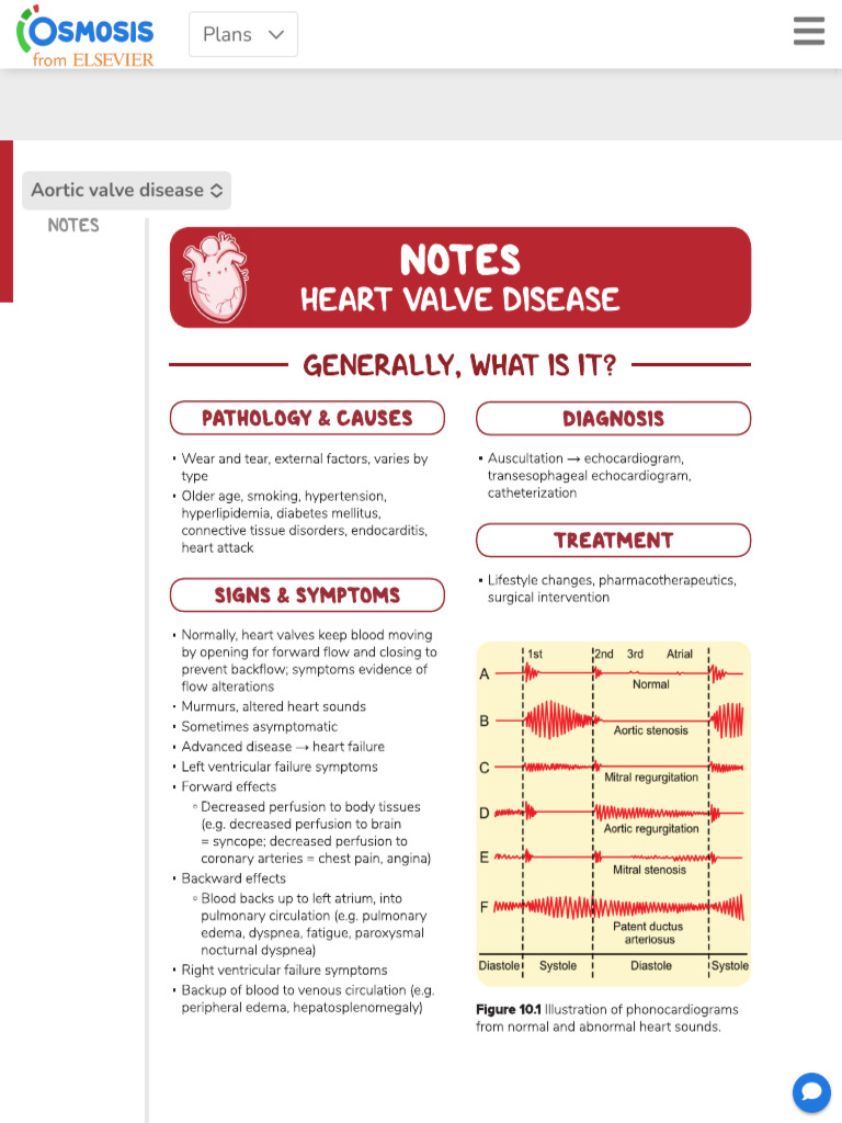Heart Valve Diseases Notes Diagrams & Illustrations Osmosis | PDF