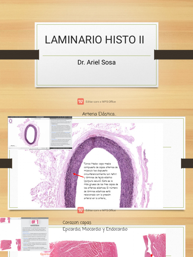 Laminario de Parcial Histo II 2023 - 20231003 - 094149 | PDF | Ganglio linfático | Anatomía humana