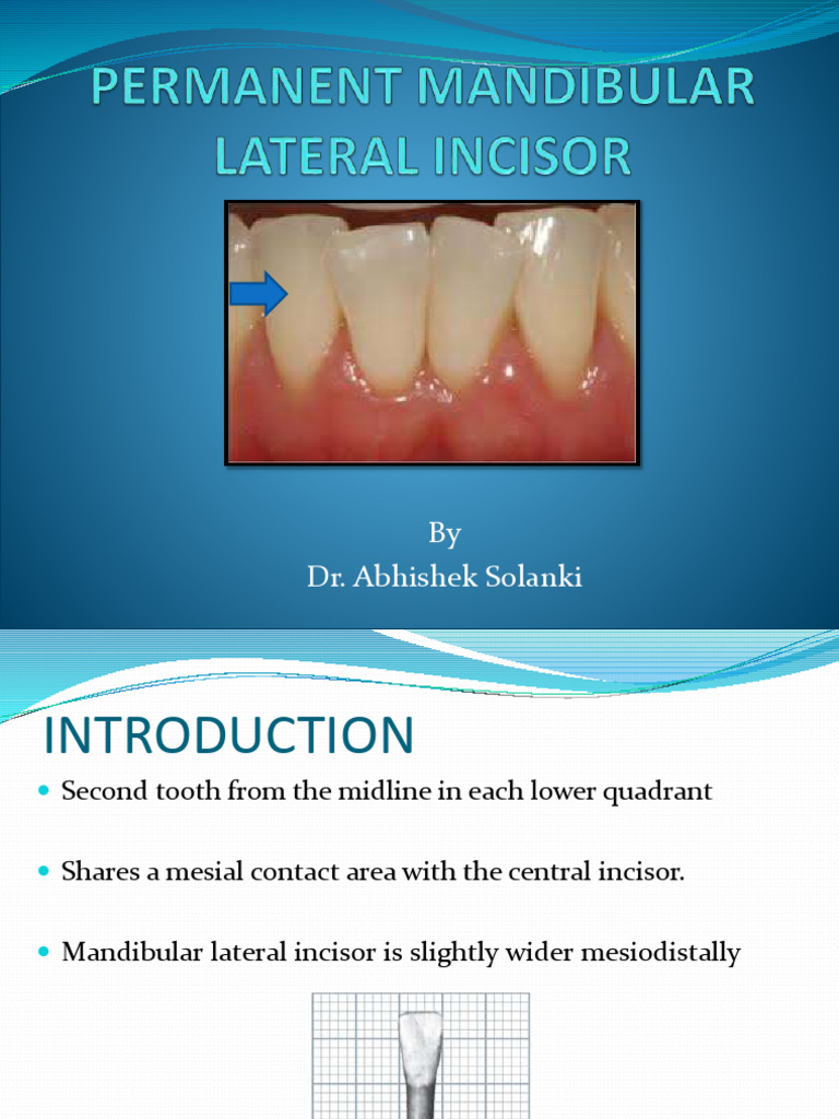 Permanent Mandibular Lateral Incisor | PDF | Dental Anatomy | Dentistry ...
