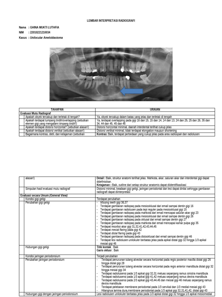 Interpretasi Radiografi Ameloblastoma | PDF