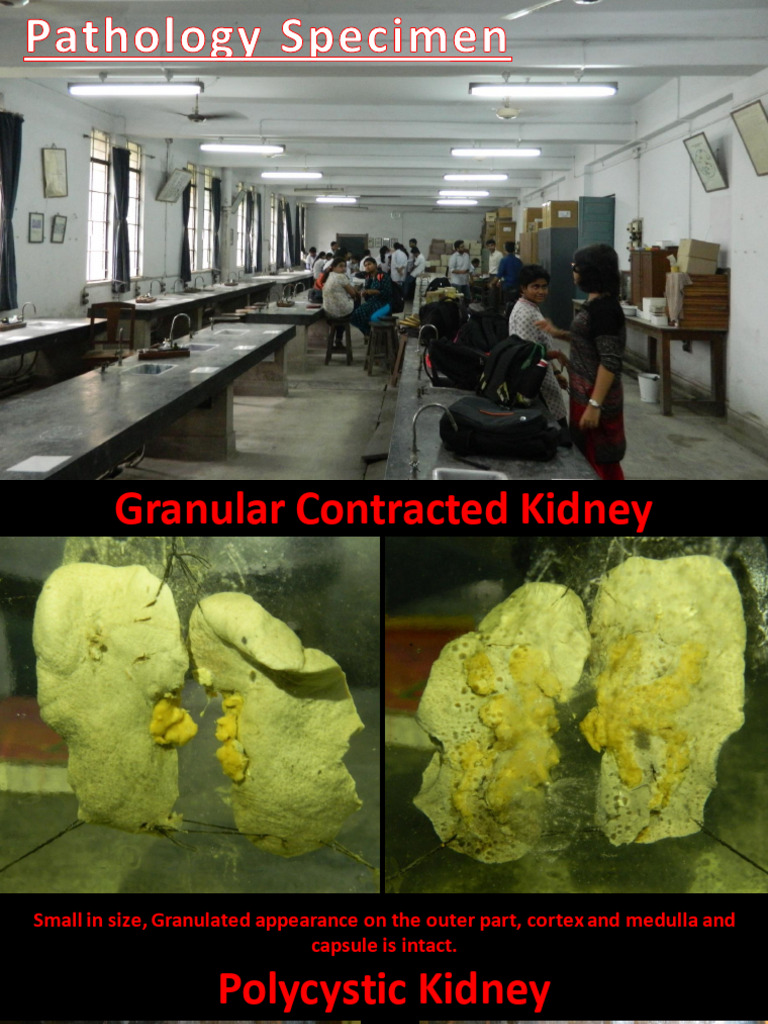 Patho Specimen | PDF