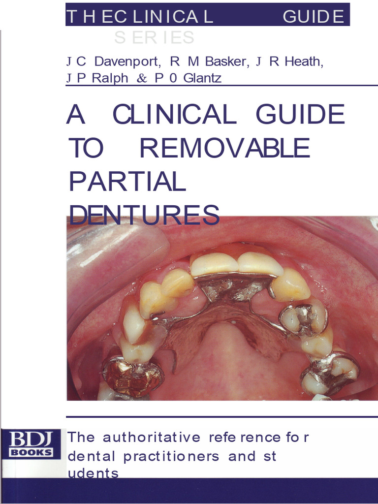 A Clinical Guide To Removable Partial Dentures PDF Free | PDF | Dentistry | Medical Specialties