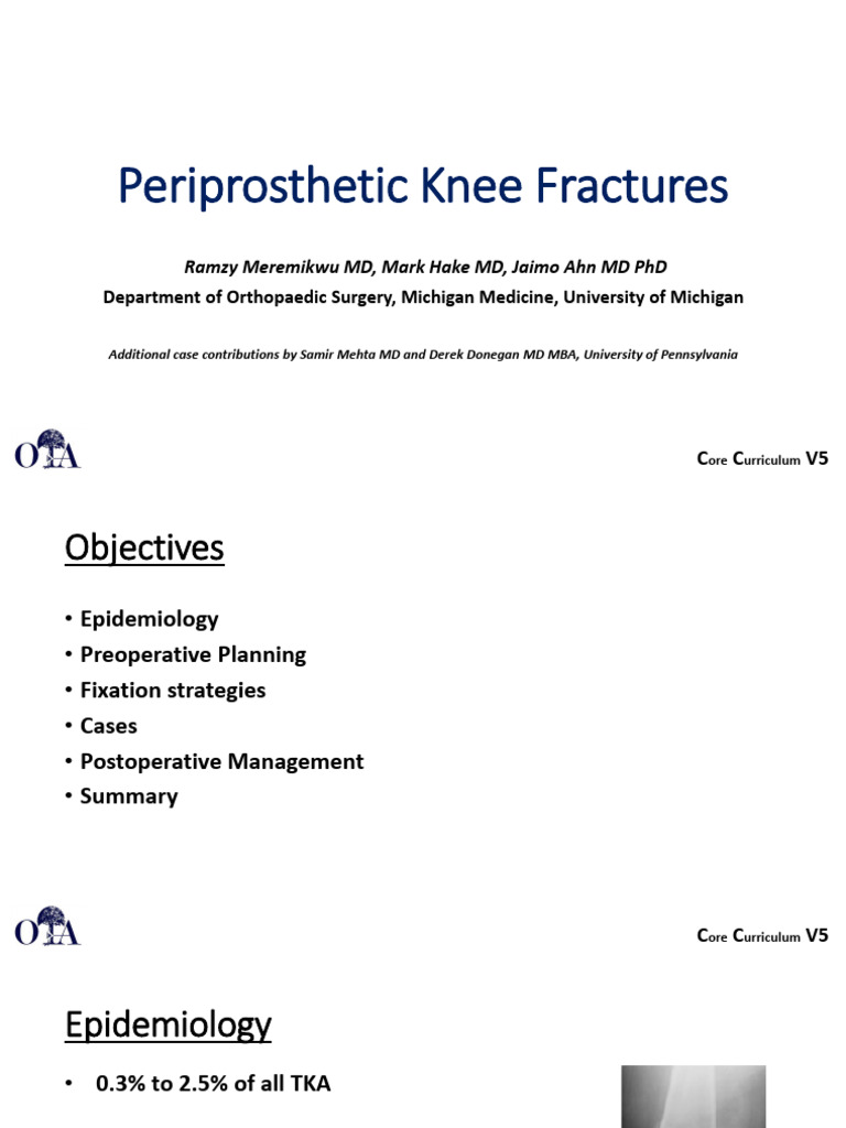 Periprosthetic Knee Fractures | PDF | Knee | Musculoskeletal Disorders