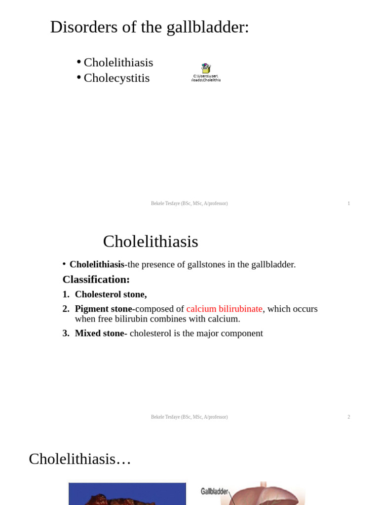 Gallbladder Disorders: Cholelithiasis & Cholecystitis | PDF | Gallbladder | Bile