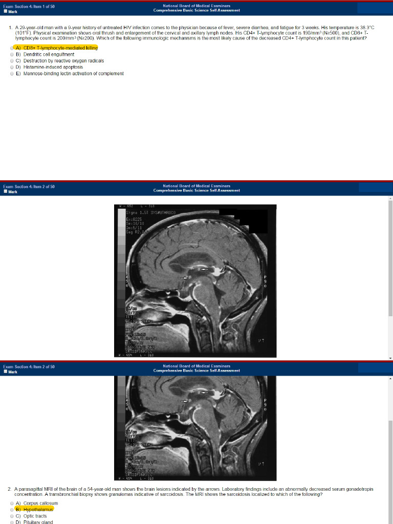 NBME 19 - Block 4 A | PDF
