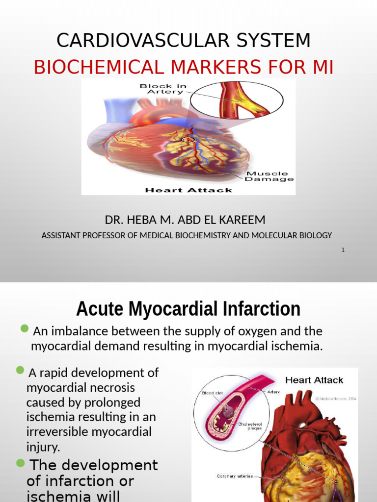 cardiac biomarkers | PDF | Lactate Dehydrogenase | Myocardial Infarction