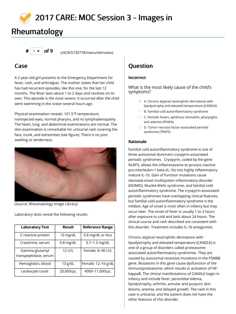 CARE ACR 2017 Images in Rheumatology | PDF | Arthritis | Medical ...
