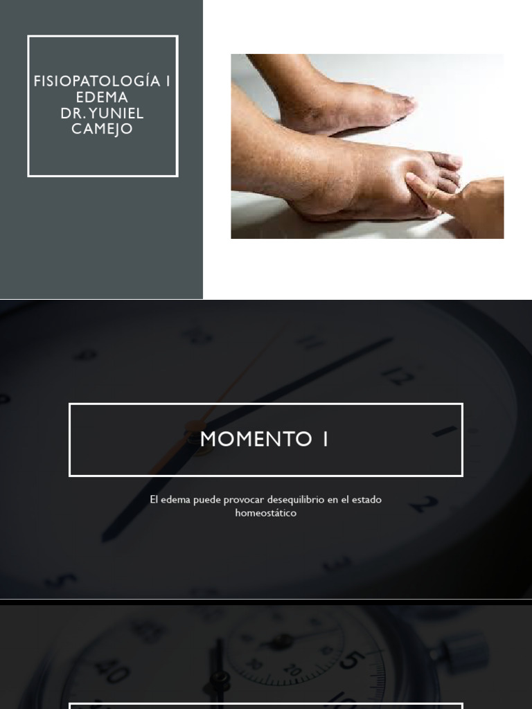 Causas y tipos de edema en fisiopatología | PDF | Edema ...