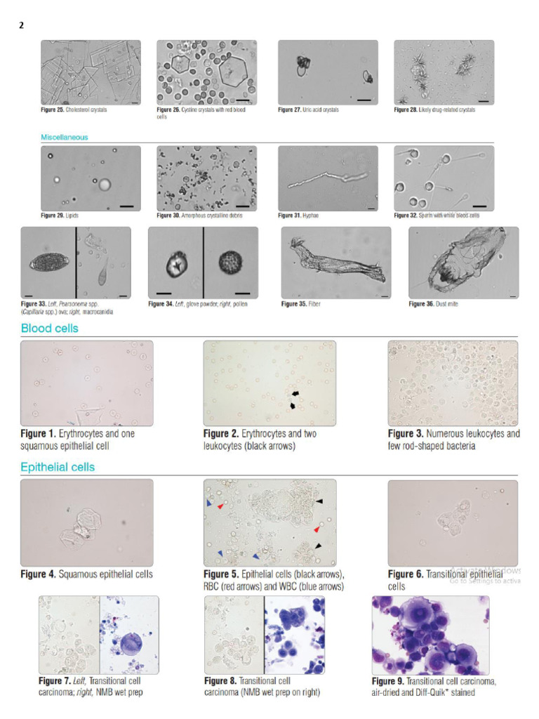 urinary sediments | PDF