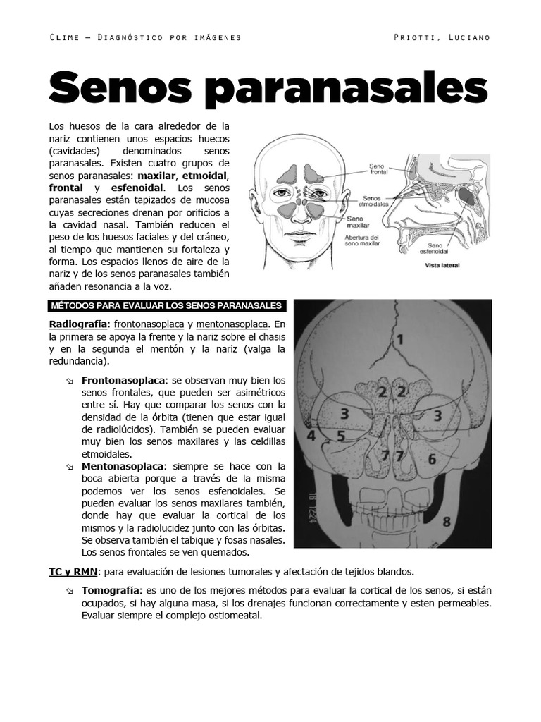 Evaluación y Síndromes de Senos Paranasales | PDF | Enfermedades y ...