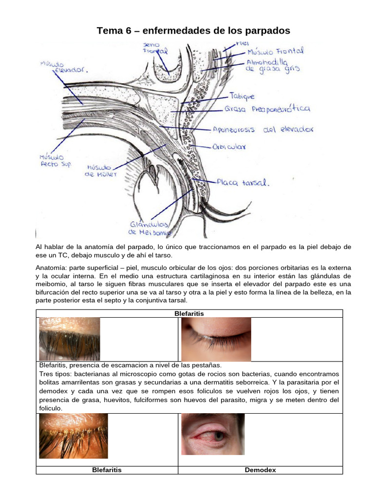 Tema 6- enfermedades del parpado | PDF