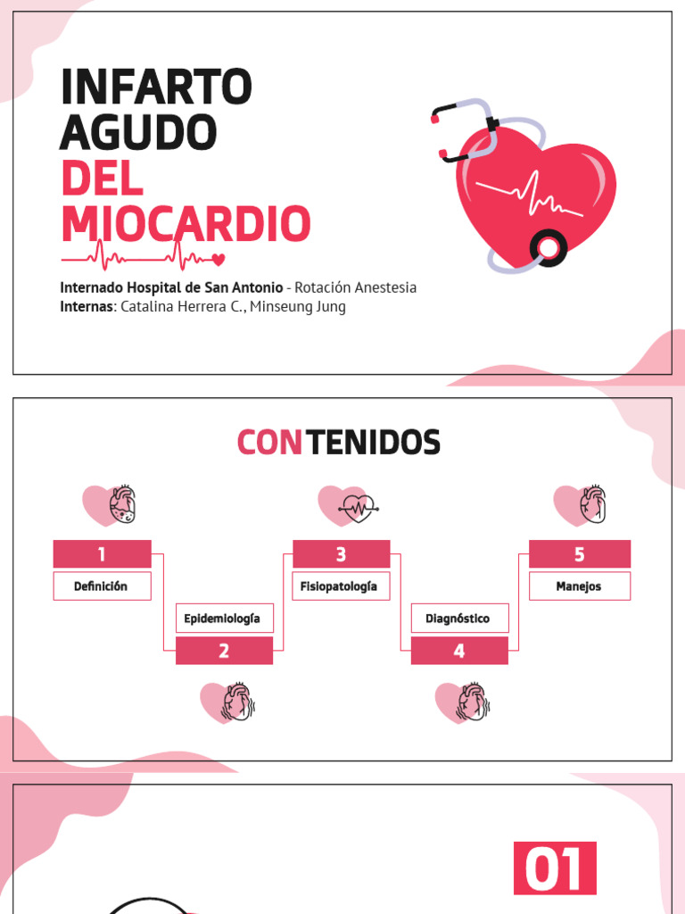Infarto Agudo de Miocardio: Guía Completa | PDF | Infarto de miocardio ...