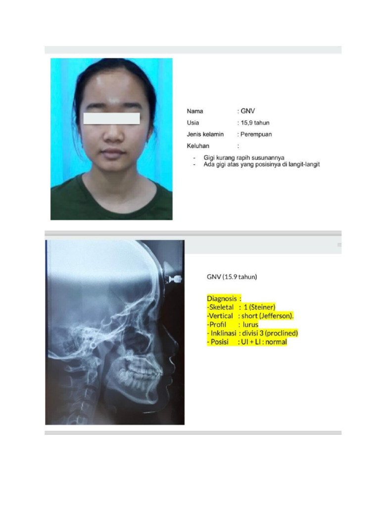 Contoh DWU GNV | PDF