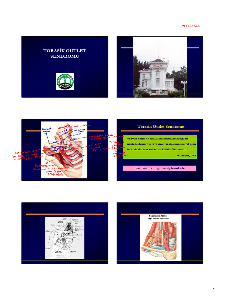 4) 08 Torasik Outlet Sendromu | PDF