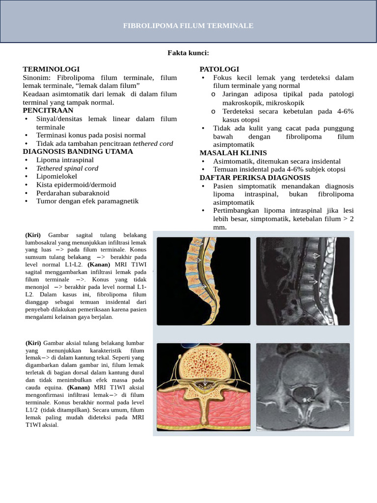 FIBROLIPOMA FILUM TERMINALE | PDF