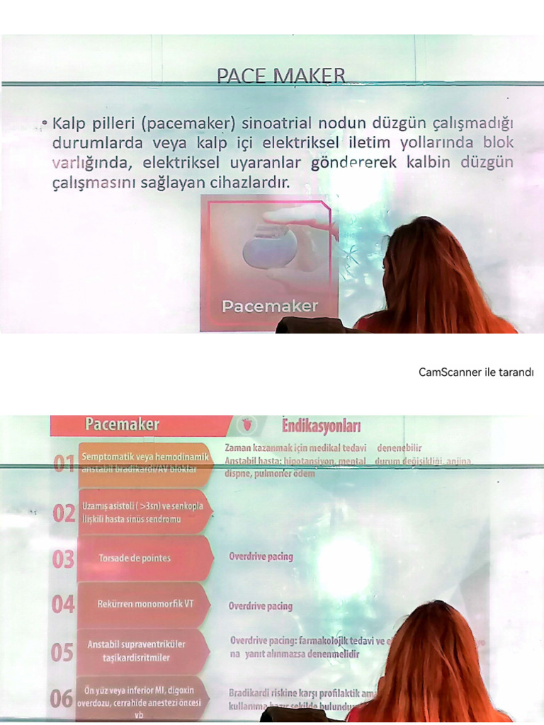 Pacemaker Ve ICD | PDF