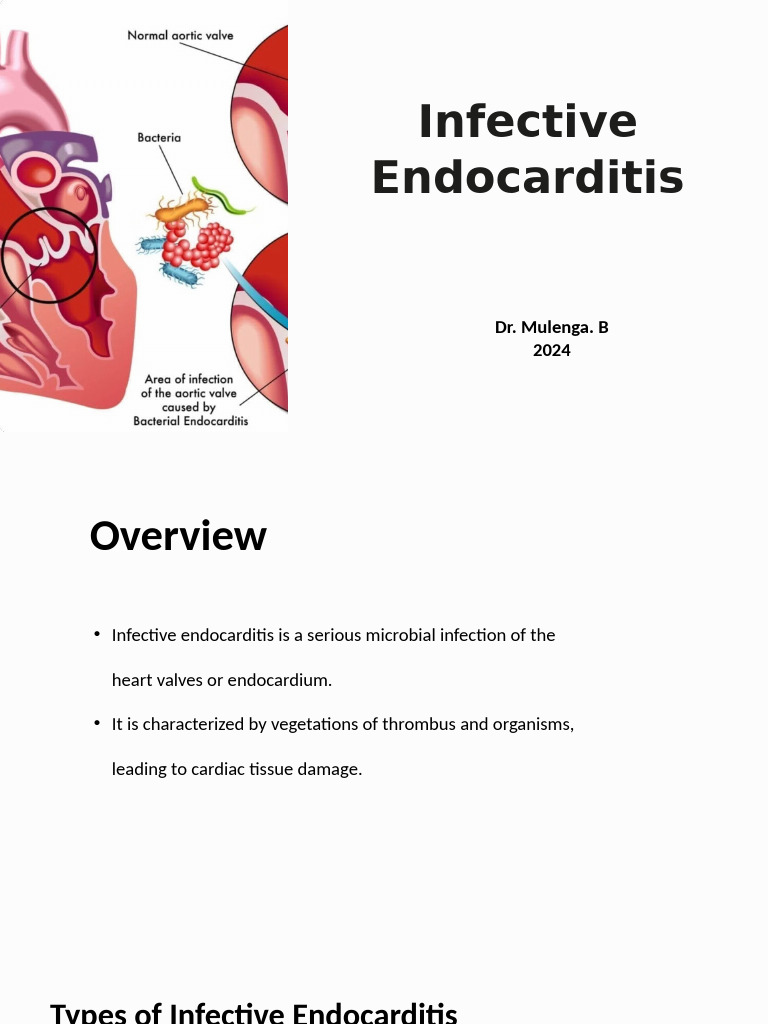 Infective Endocarditis Overview & Management | PDF | Medical ...