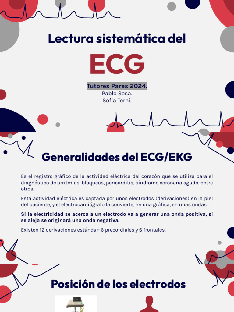 Lectura sistemática del ECG | PDF | Electrocardiografia ...