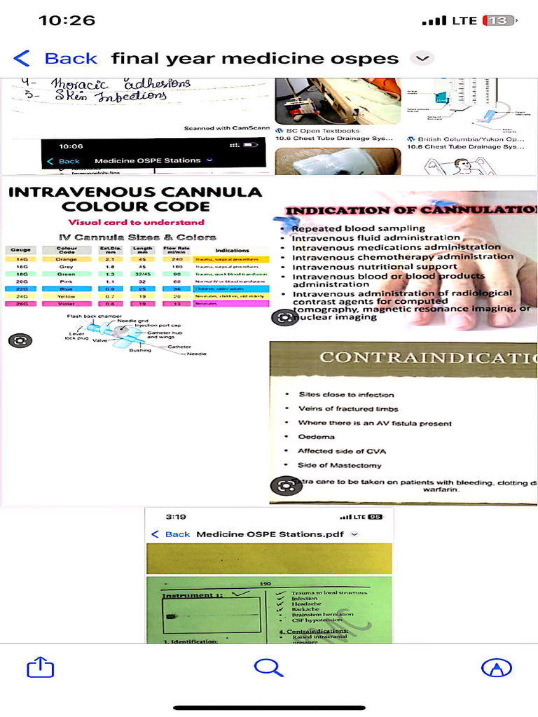 Ospes Surgery by DR Shahzaib Sikander Me | PDF